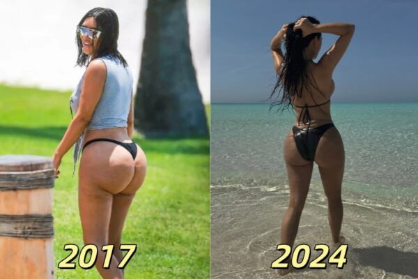 Kim Kardashian Before Surgery: Did She Look Better? - A Southern Fairytale